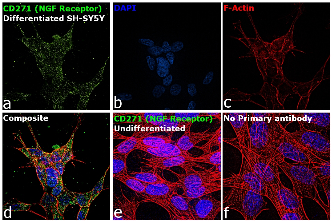CD271 (NGF Receptor) Antibody (MA5-31968)