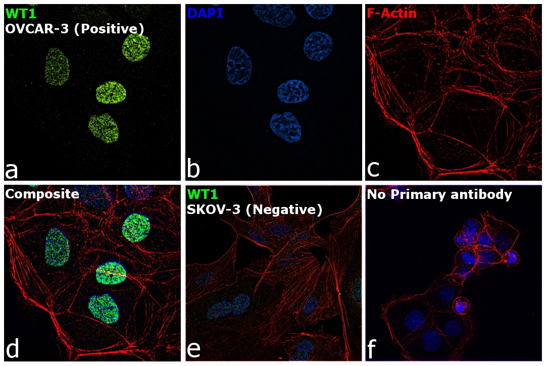 WT1 Antibody (MA5-32215)