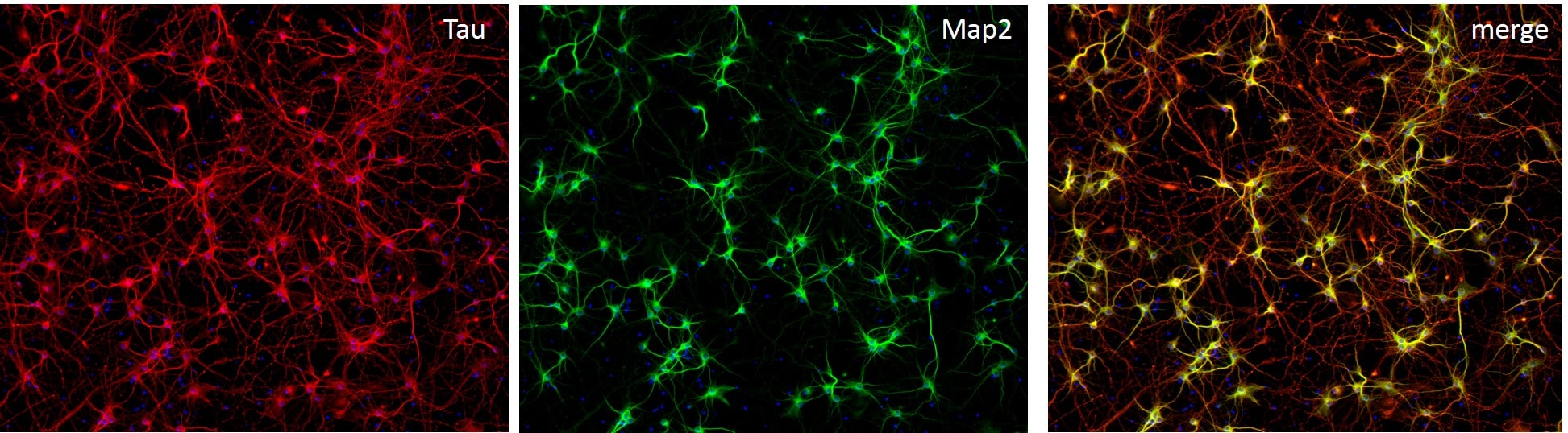 MAP2 Antibody (PA5-17646)