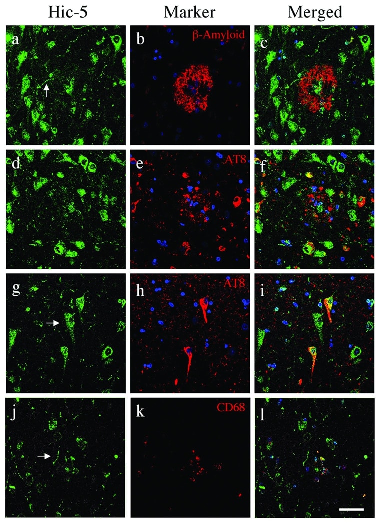 Phospho-Tau (Ser202, Thr205) Antibody, Biotin (MN1020B)