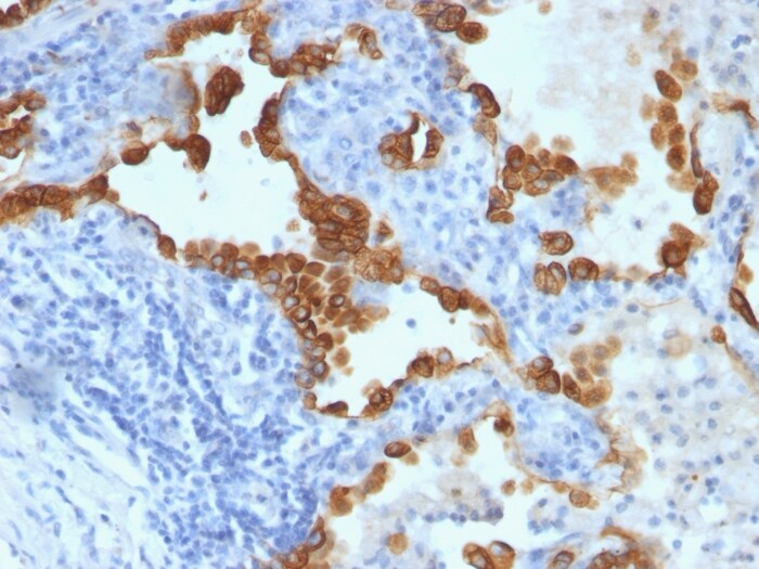 Cytokeratin 8/18 Antibody (MSM20-1221-P1)