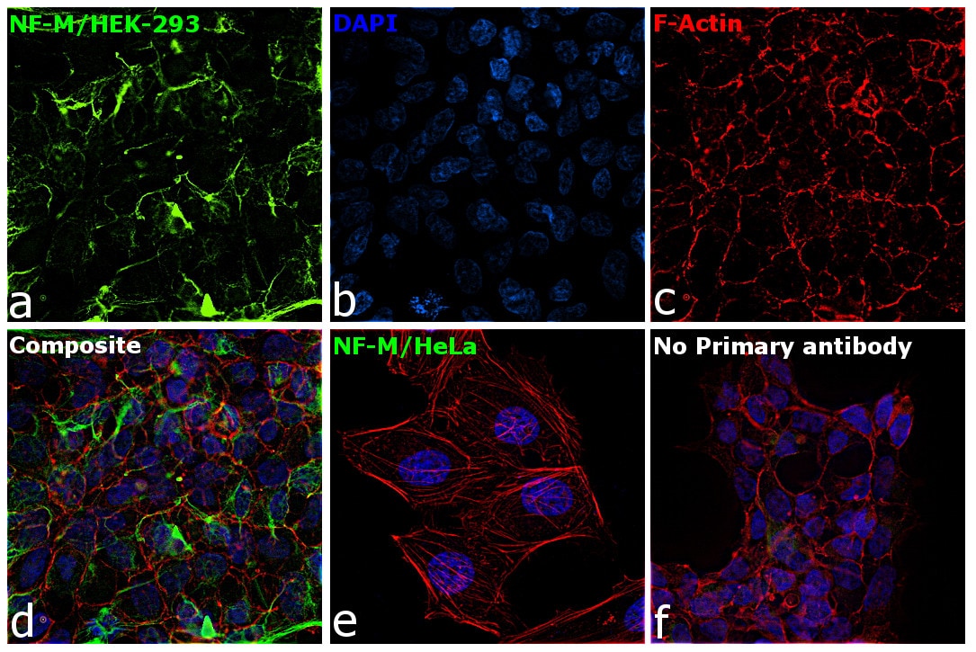 NEFM Antibody (OMA1-06110)