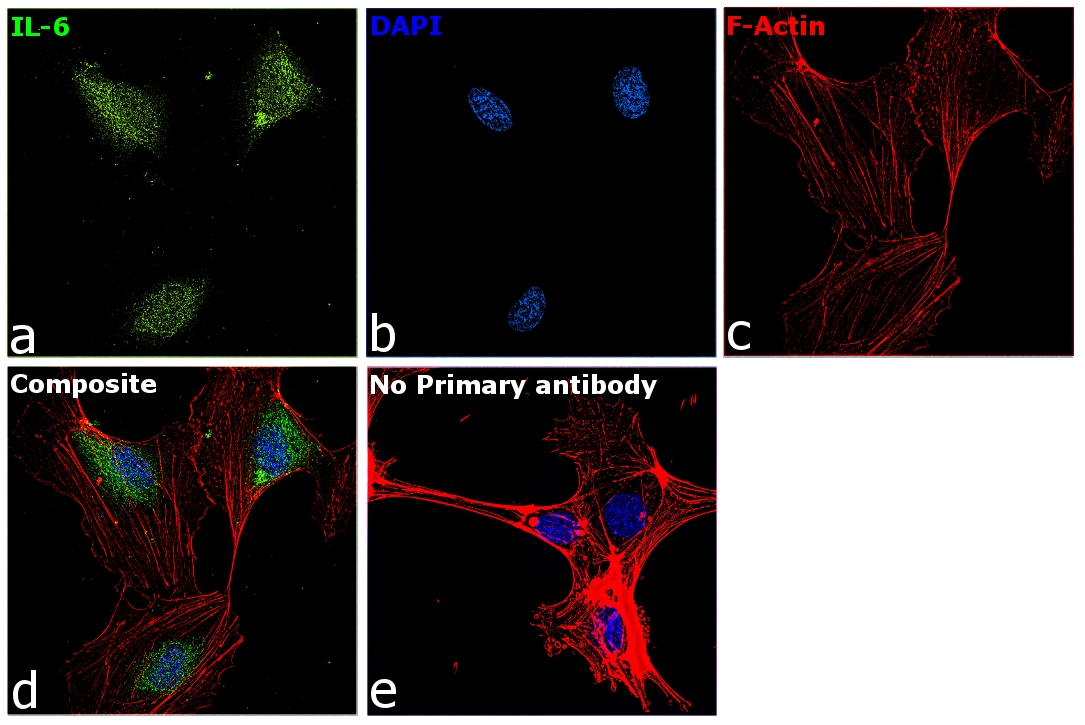IL-6 Antibody (P620)