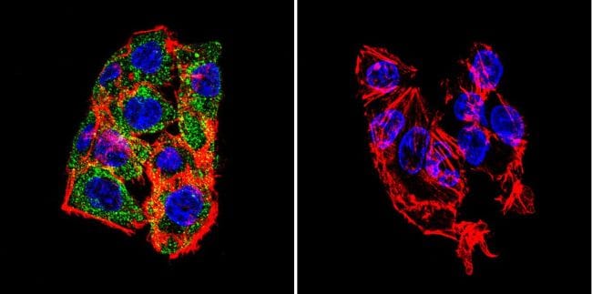 LAMP2 Antibody (PA1-655)