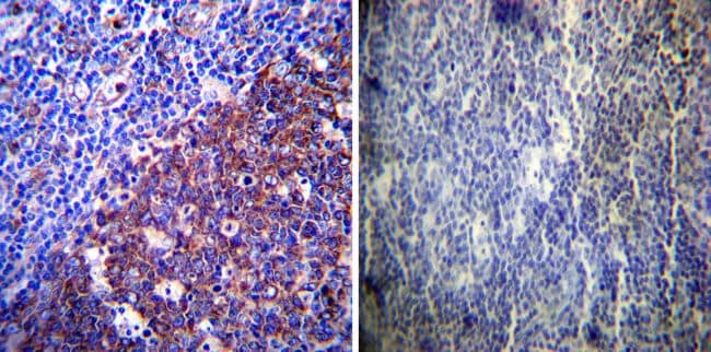 LAMP2 Antibody (PA1-655)