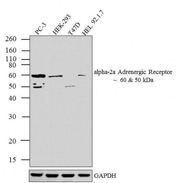 alpha-2a Adrenergic Receptor Antibody (PA1-048)