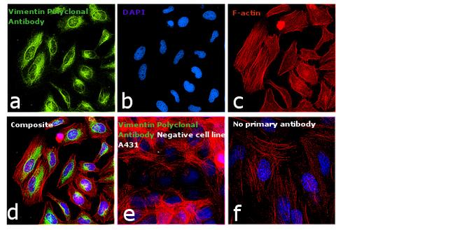 Vimentin Antibody (PA1-10003)