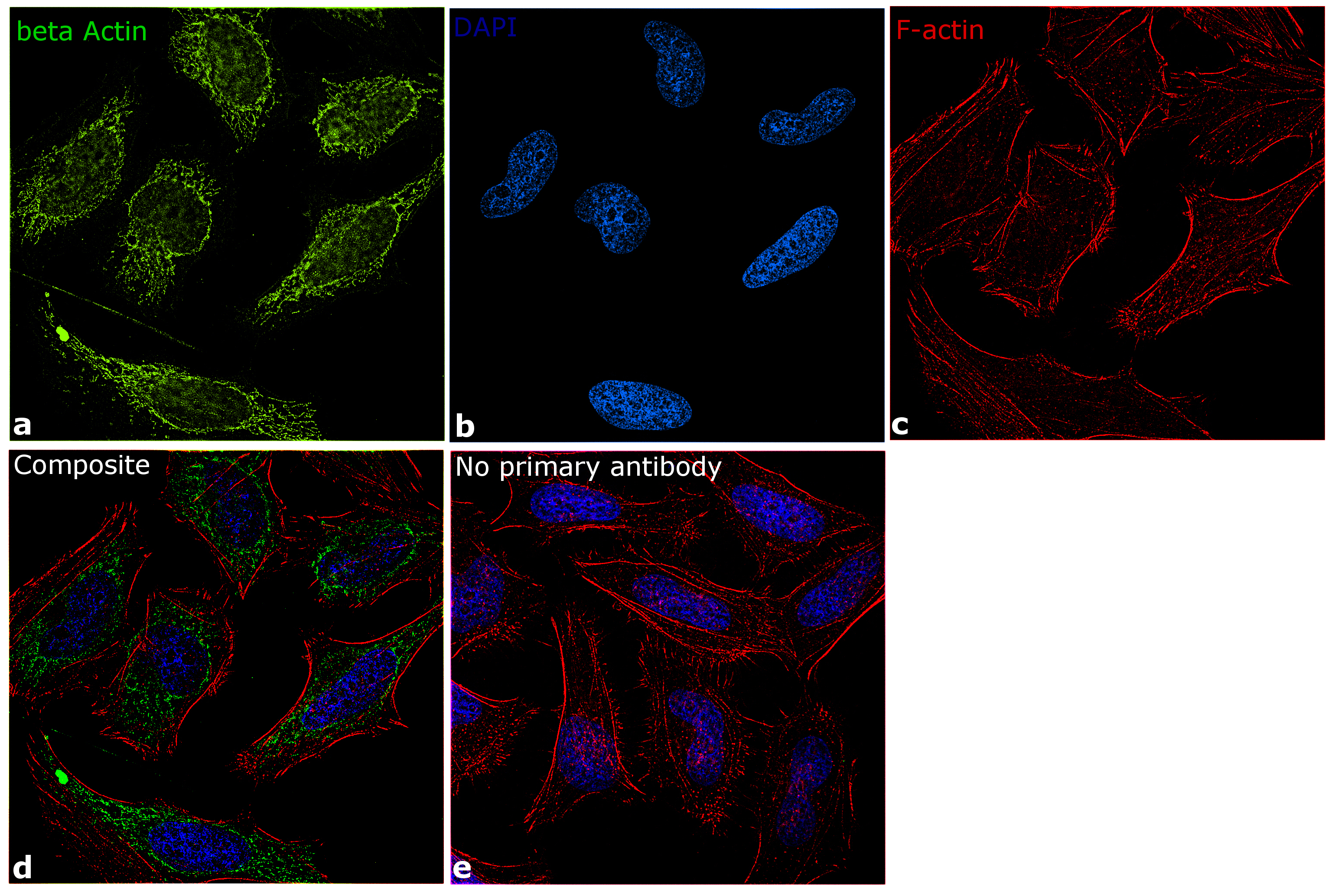 beta Actin Antibody (PA1-16889)