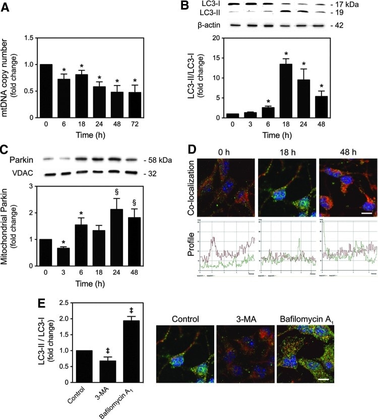 LC3A/LC3B Antibody (PA1-16931)