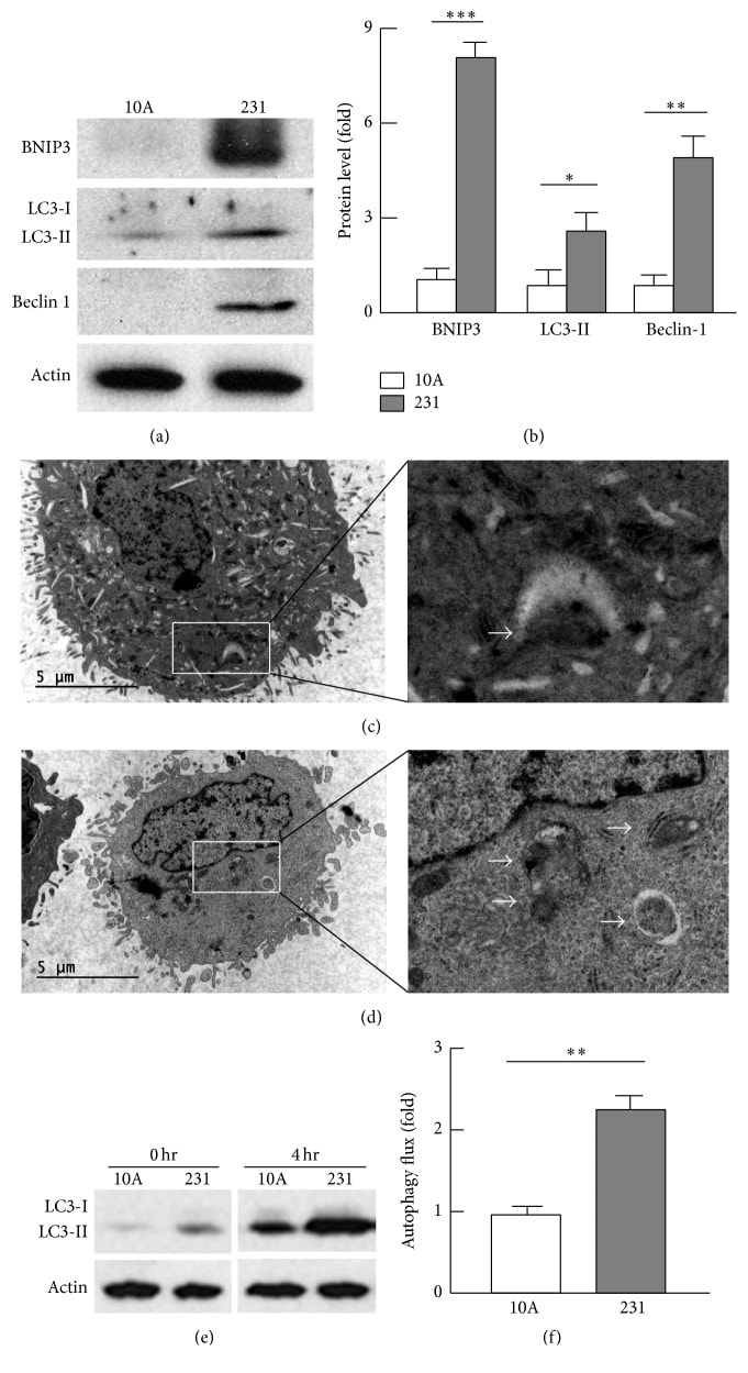 LC3A/LC3B Antibody (PA1-16931)