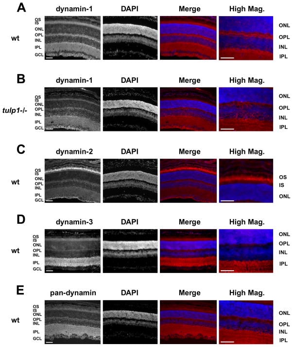 Dynamin 1 Antibody (PA1-660)