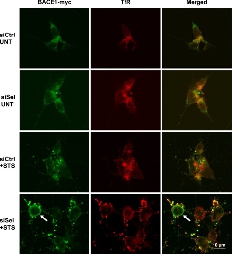 BACE1 Antibody (PA1-757)