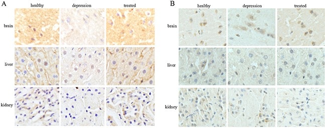 TPH1 Antibody (PA1-777)