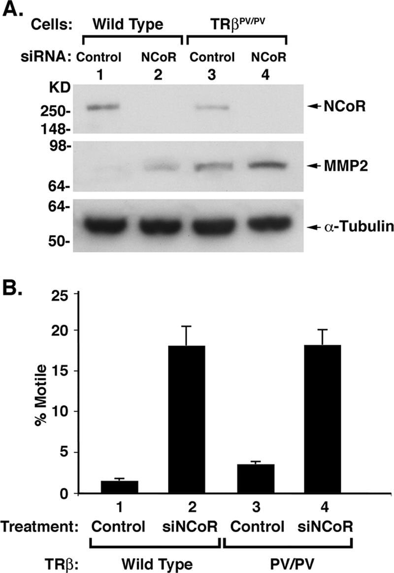 NCoR1 Antibody (PA1-844A)