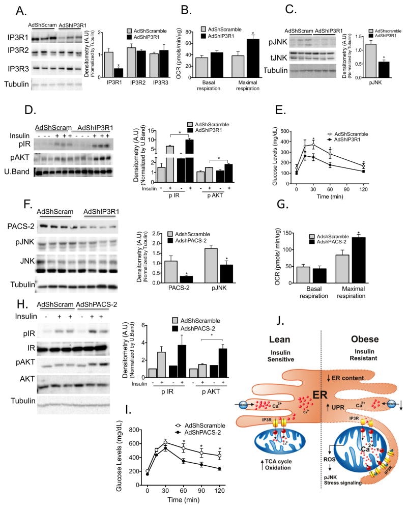 IP3 Receptor 1 Antibody (PA1-901)