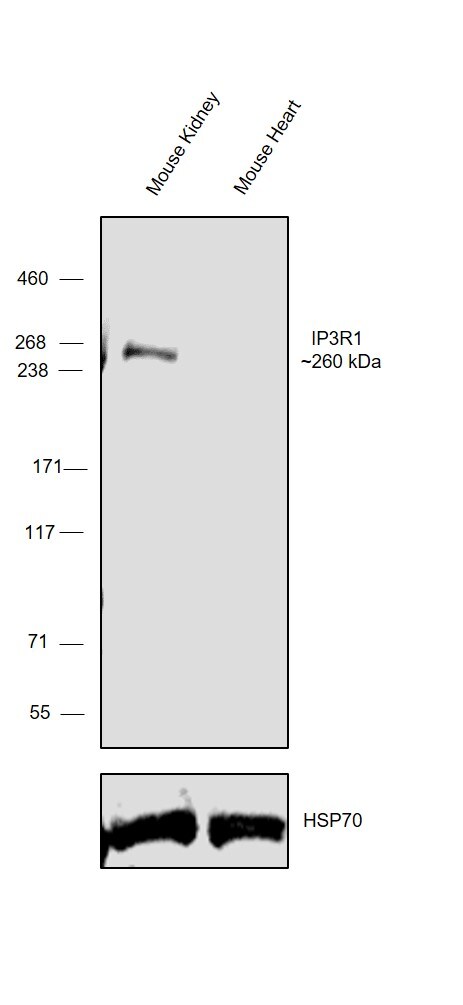 IP3 Receptor 1 Antibody (PA1-901)