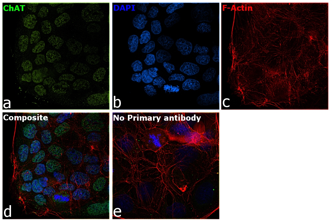 ChAT Antibody (PA1-9027)