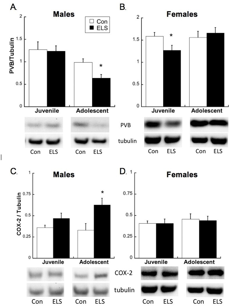 Parvalbumin Antibody (PA1-933)