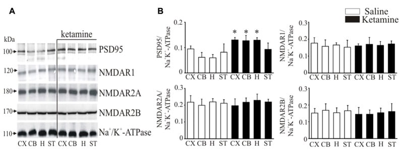 NMDAR2A Antibody (A-6473)