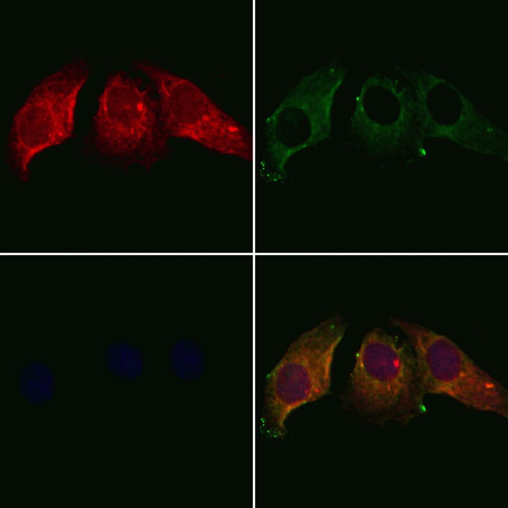 Calumenin Antibody (PA5-100420)