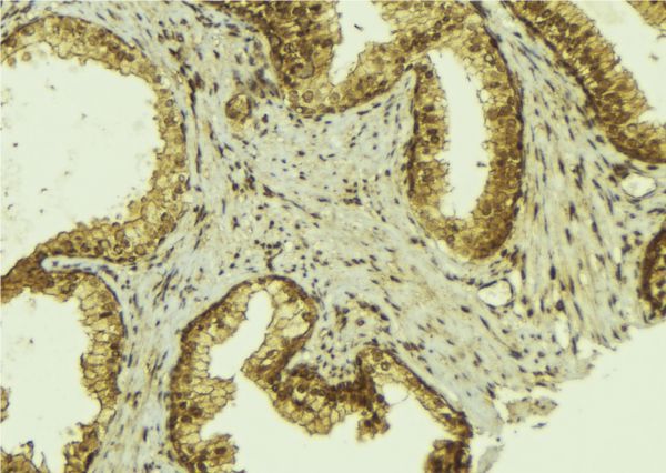 TFE3 Antibody (PA5-101090)