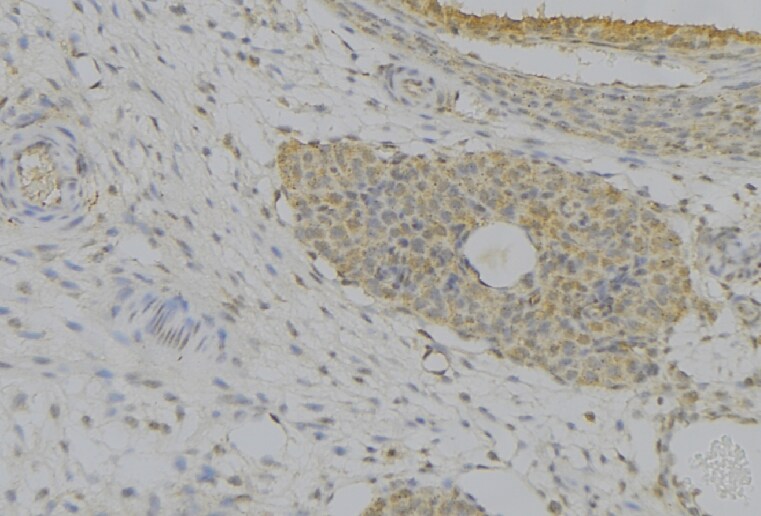 IGFBP7 Antibody (PA5-102670)