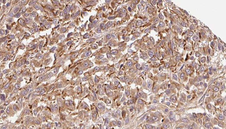 Cystatin F Antibody (PA5-103772)
