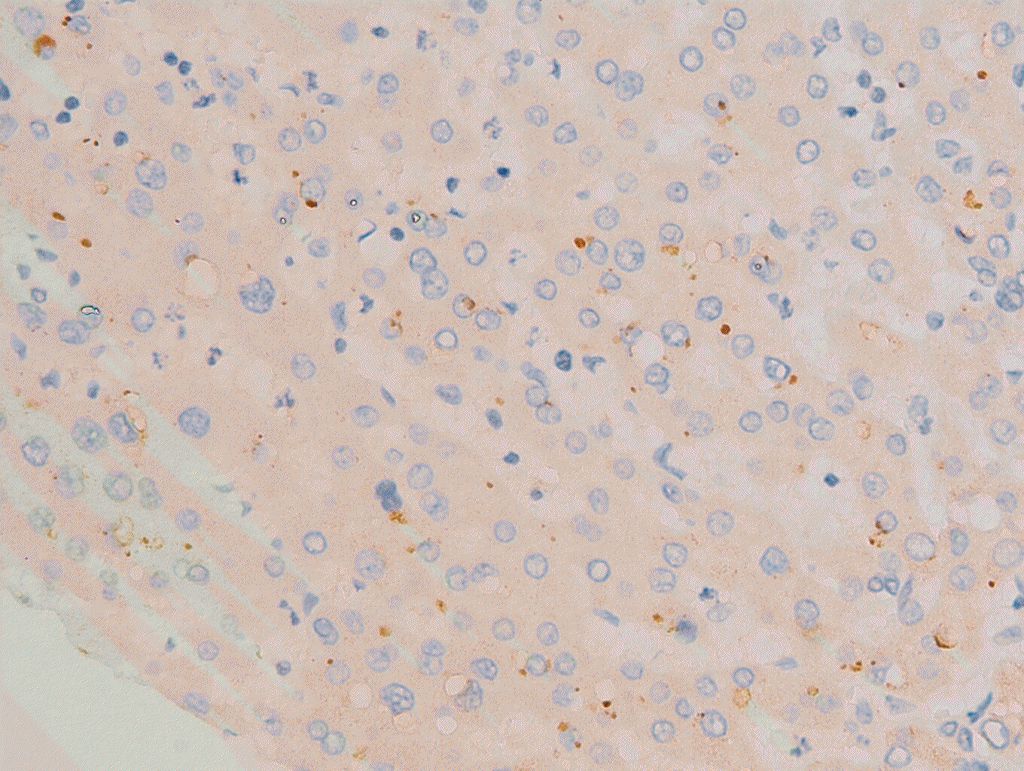 Phospho-c-Fos (Ser362) Antibody (PA5-104728)