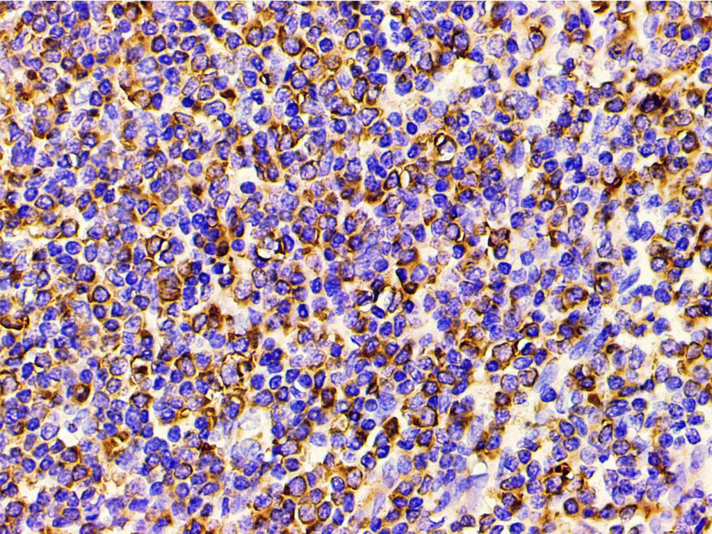 Phospho-PI3K p85 alpha (Tyr607) Antibody (PA5-104853)