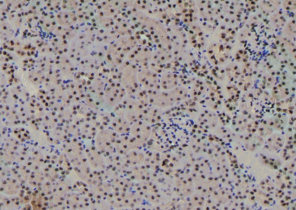 Phospho-RUNX2 (Ser275) Antibody (PA5-105642)