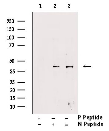Phospho-STING (Ser366) Antibody (PA5-105674)