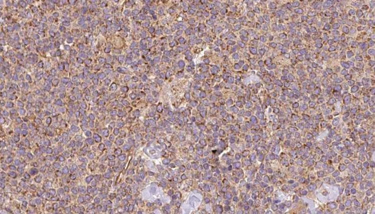 ALP Antibody (PA5-106391)