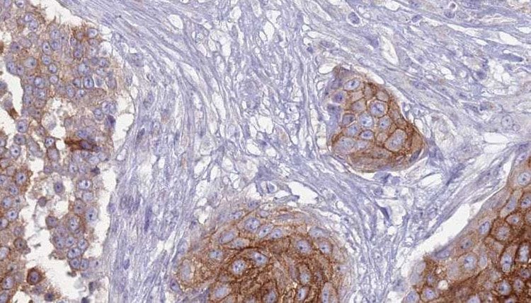 CD16 Antibody (PA5-106915)