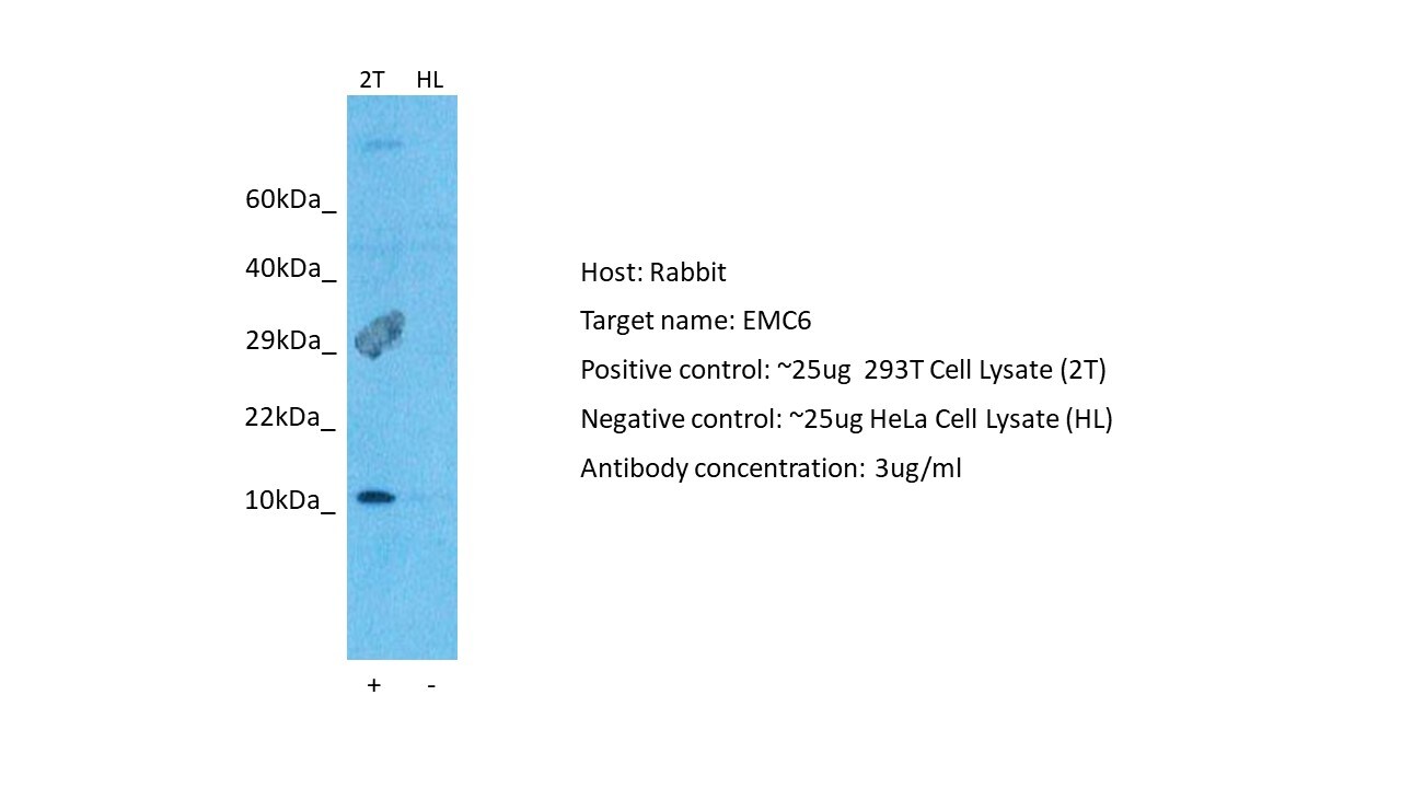 EMC6 Antibody (PA5-107119)