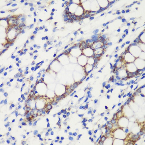 TOM20 Antibody (PA5-110506)