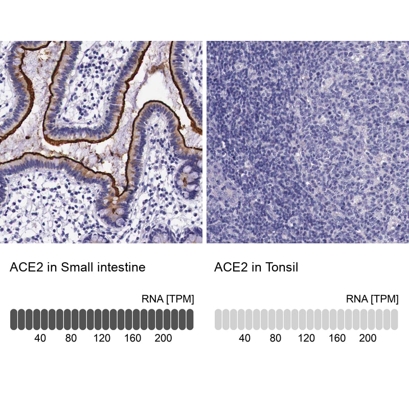 ACE2 Antibody (PA5-110613)