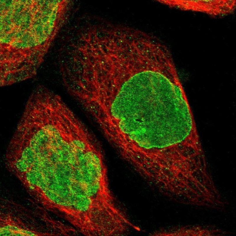 BRIP1 Antibody (PA5-110693)