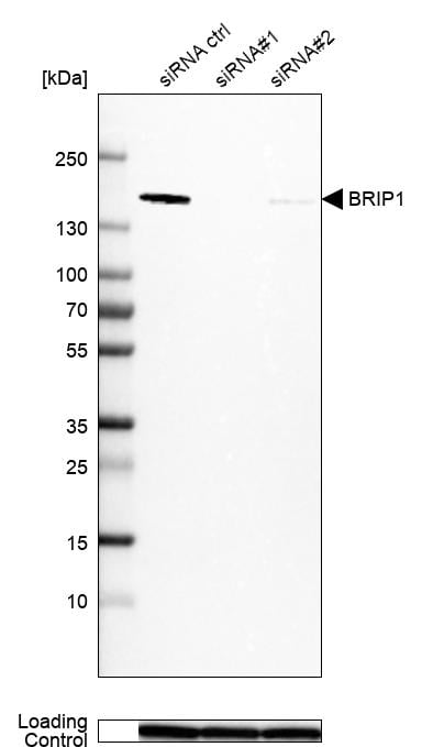 BRIP1 Antibody (PA5-110693)