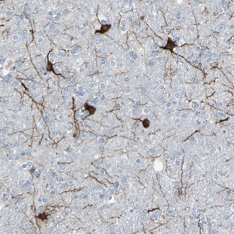MAP2 Antibody (PA5-110744)