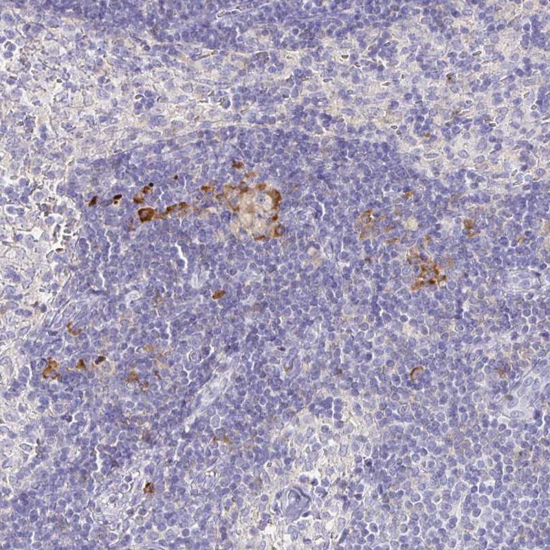 CXCR3 Antibody (PA5-111225)