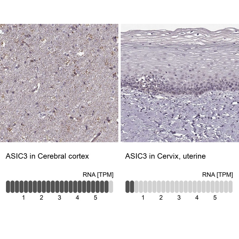 ASIC3 Antibody (PA5-111401)