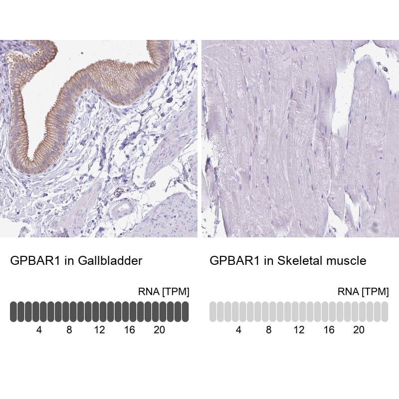 TGR5 Antibody (PA5-111557)