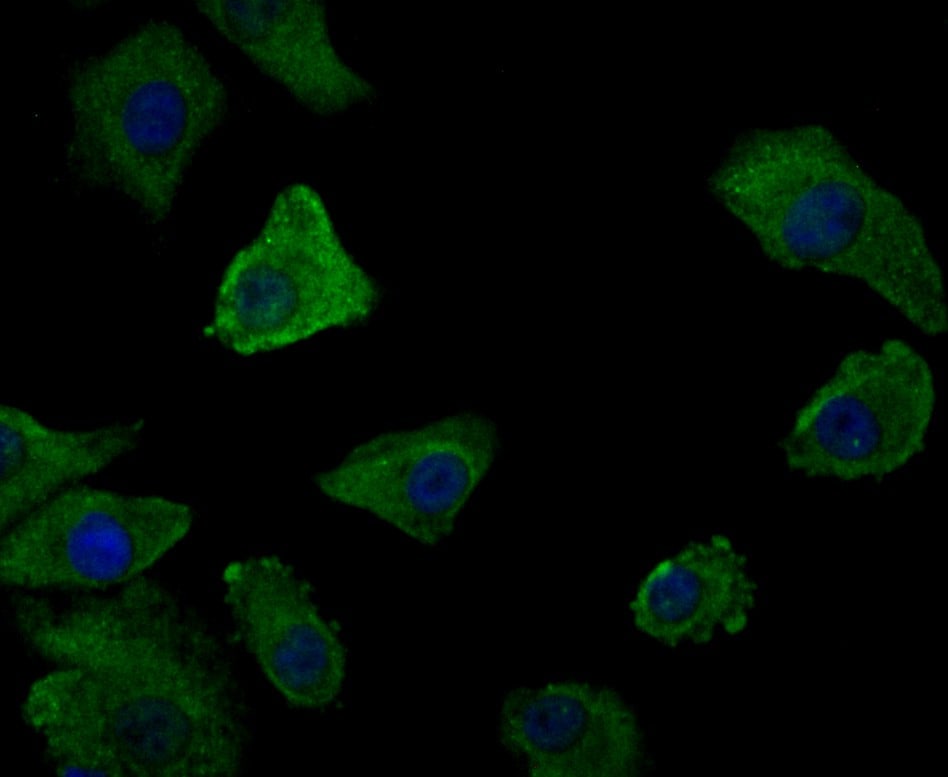 Desmoglein 3 Antibody (PA5-114323)
