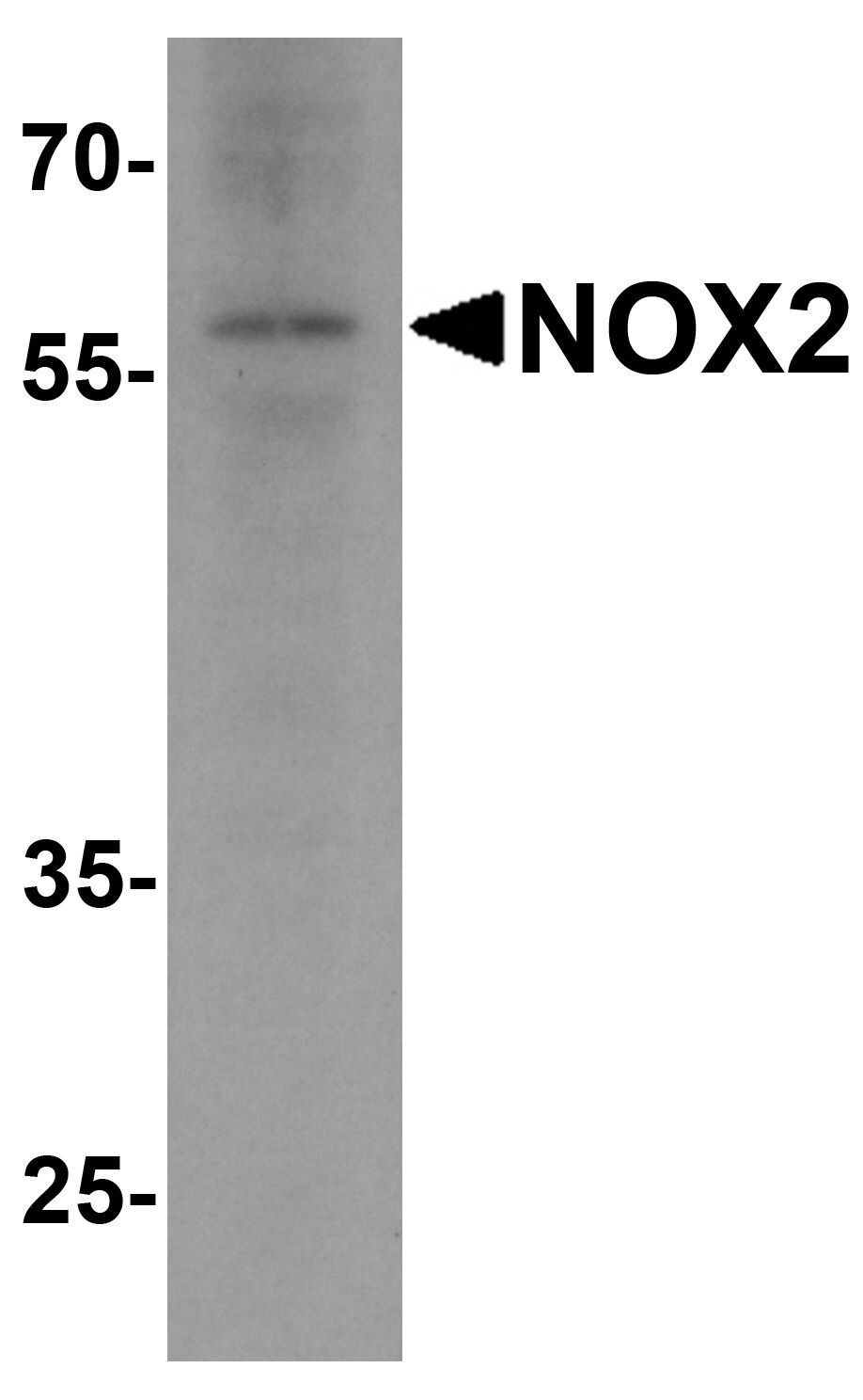 NOX2 Antibody (PA5-114489)