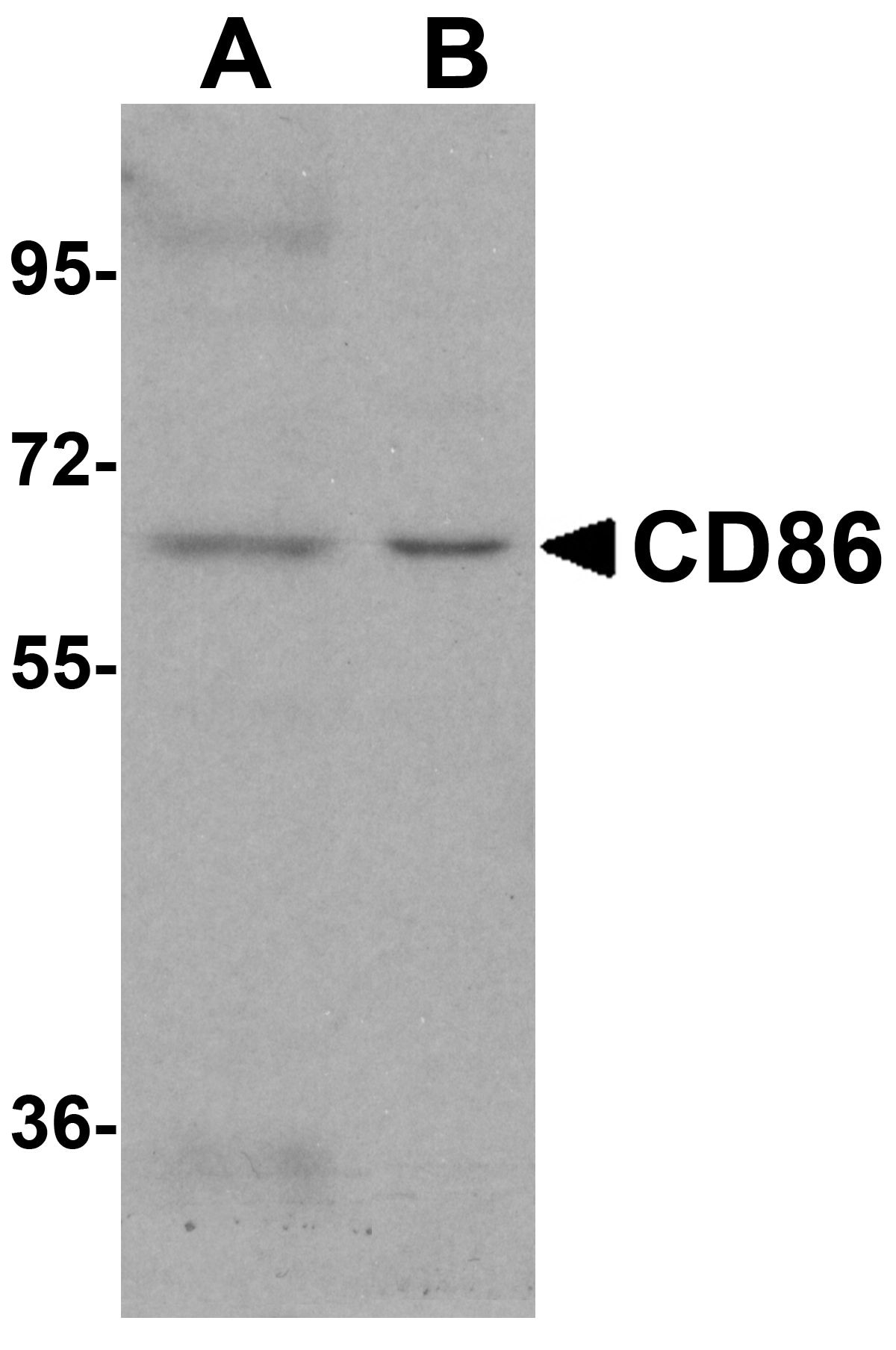 CD86 Antibody (PA5-114521)