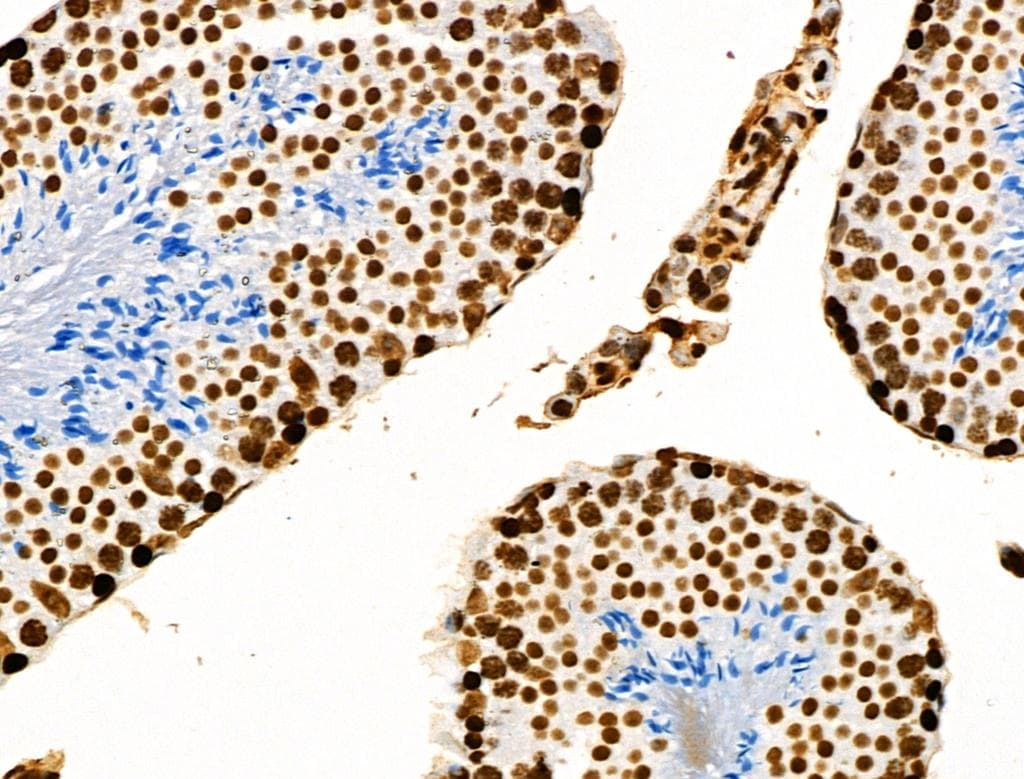 Histone H3ac (pan-acetyl) Antibody (PA5-114693)