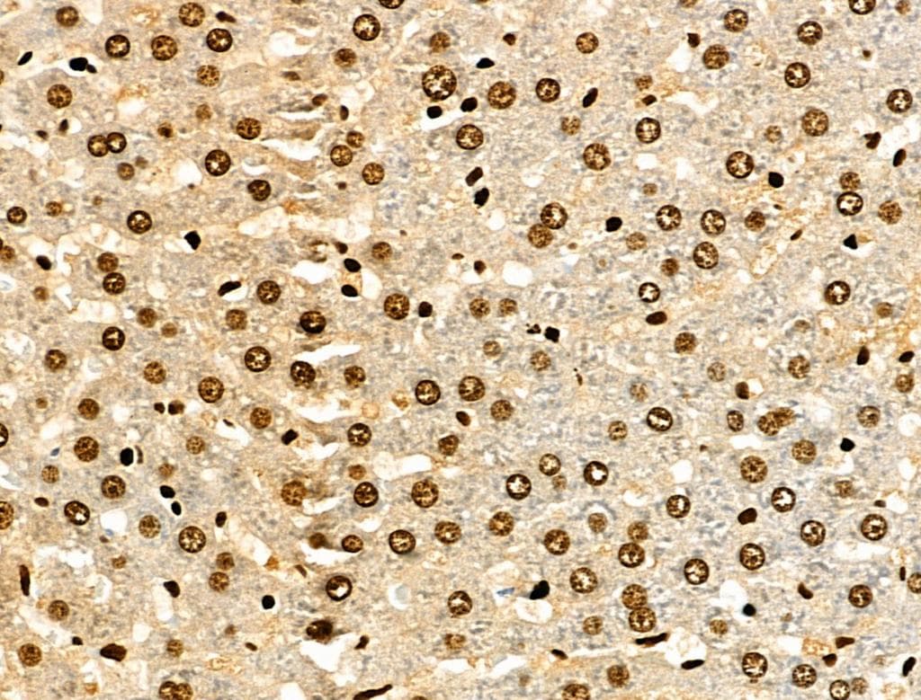 Histone H3ac (pan-acetyl) Antibody (PA5-114693)