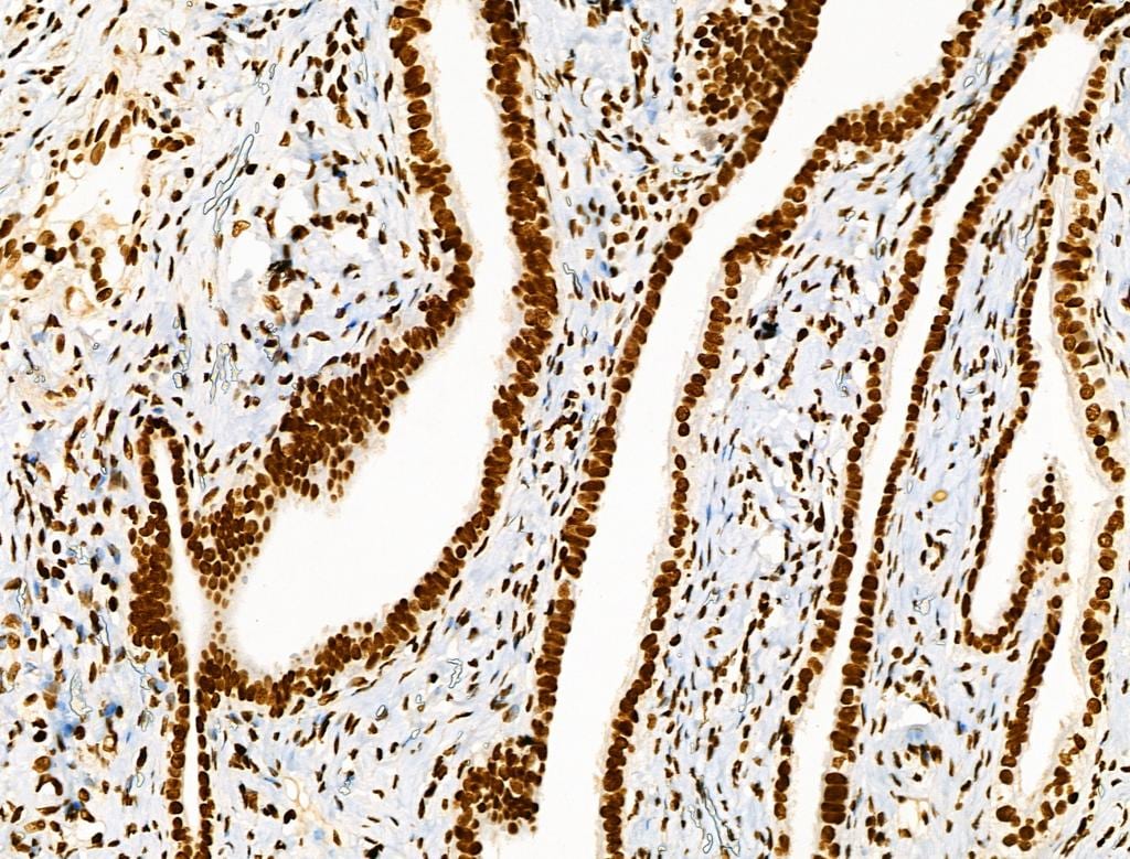 Histone H3ac (pan-acetyl) Antibody (PA5-114693)