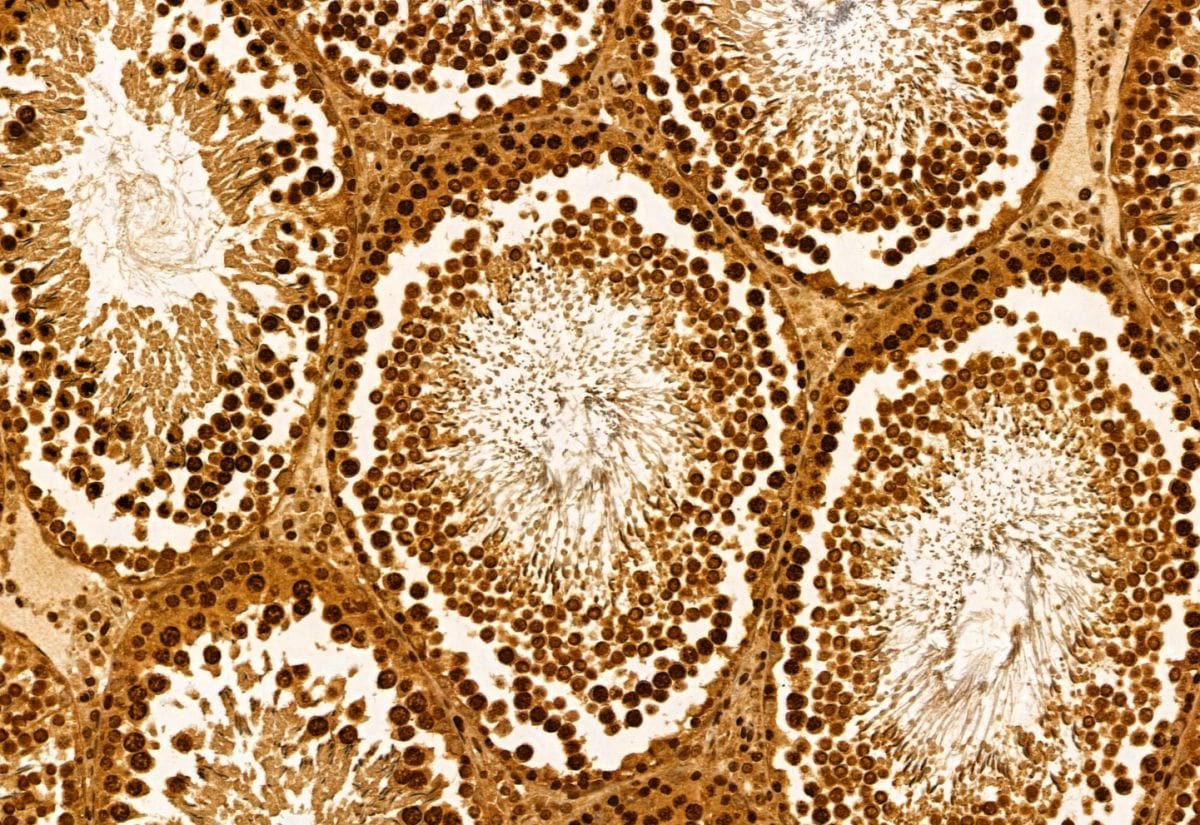 ACOX1 Antibody (PA5-114813)