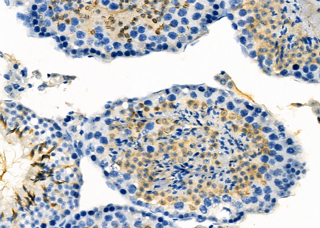 IBSP Antibody (PA5-114915)